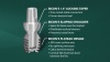 Bicon SHORT® Implants - Bicon Dental Implants