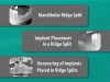 Mandibular Ridge Split, Placement of Two Bicon SHORT® Implants in a ...