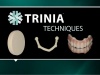 TRINIA® Techniques - Bicon Dental Implants